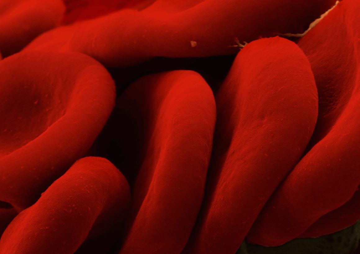 MEDIA BLOOD AGAR PLATE - Darah Domba